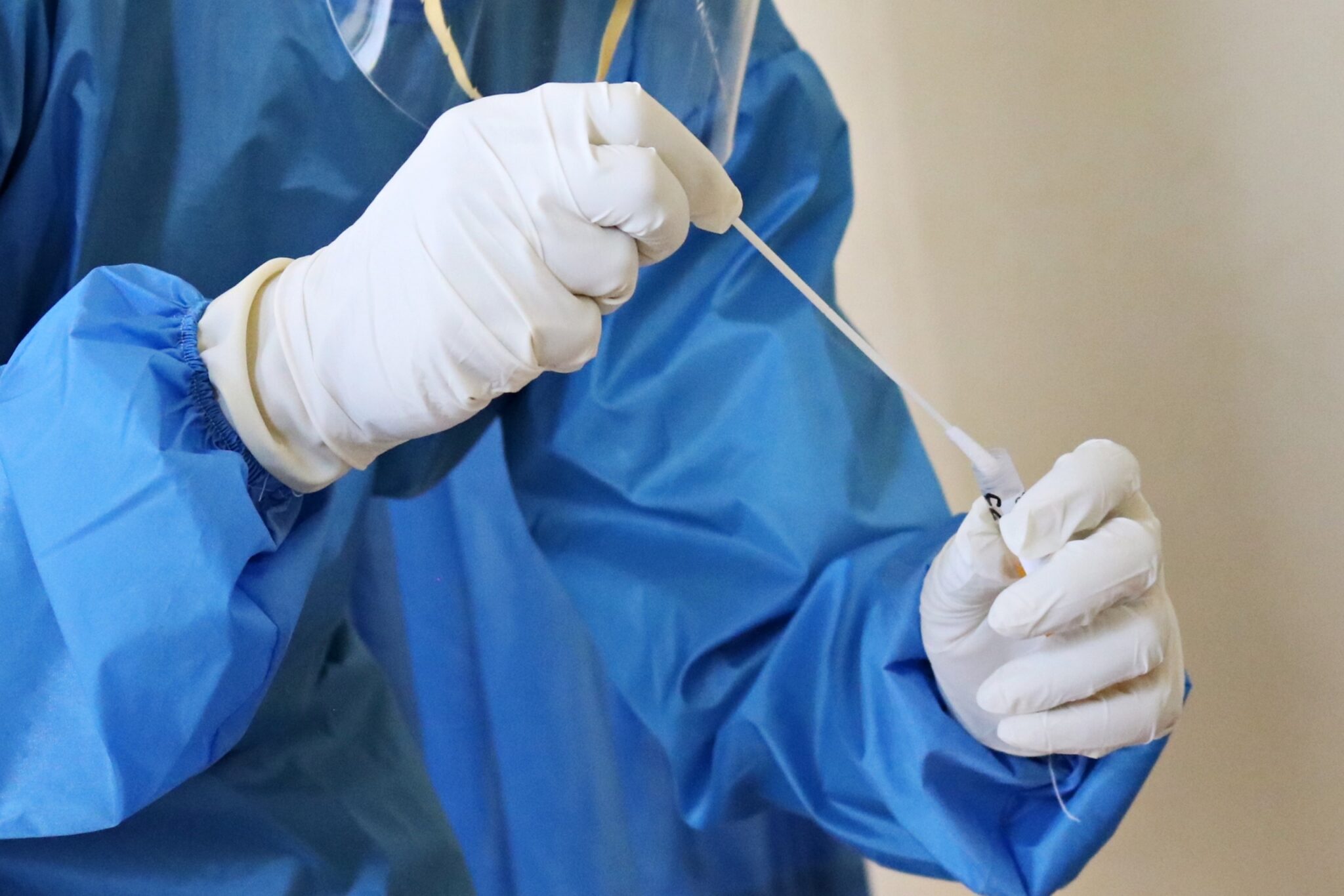 Fecal Transplant: What You Need to Know – Gastroenterology Health Partners